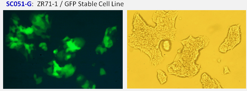 ZR-75-1 / GFP (Puromycn) stable cell line